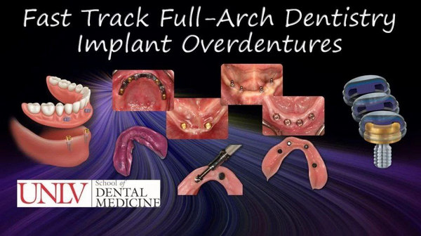 Full-Arch Dentistry – Implant Overdentures - Dental Courses