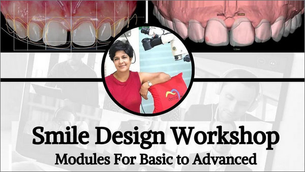 Smile Design Workshop, Modules for Basic to Advanced - Dental Courses
