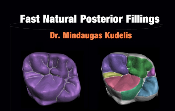 Fast Natural Posterior Fillings - Dental Courses