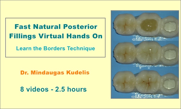 Fast Natural Posterior Fillings Virtual Hands On - Dental Courses