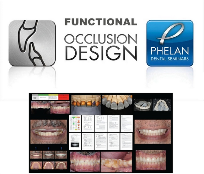 Functional Occlusion Design Dental Seminars Full Bonus Package Dental Courses
