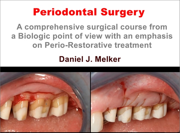 Periodontal Surgery: A Comprehensive Surgical Course - Dental Courses