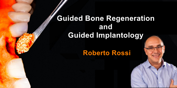 Guided Bone Regeneration and Guided Implantology - Dental Courses
