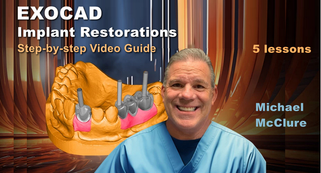EXOCAD Implant Restorations: Step-by-step Video Guide - Dental Courses
