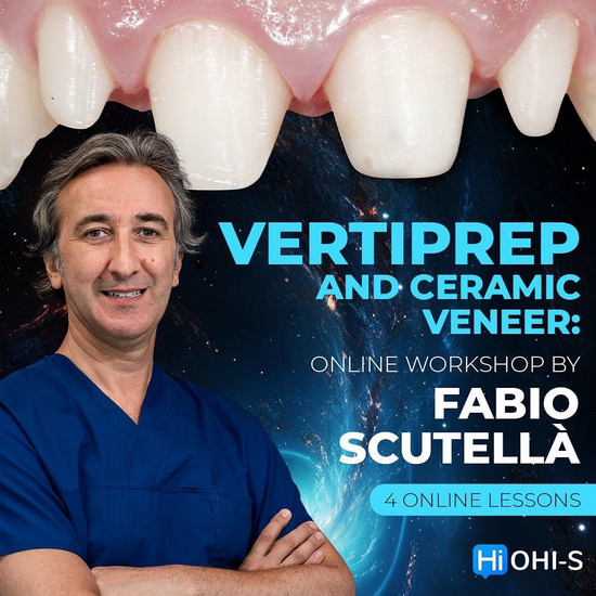 Vertical Preparation and Ceramic Veneers (VertiPrep) - Dental Courses