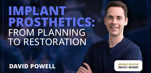 Implant Prosthetics: from Planning to Restoration - Dental Courses